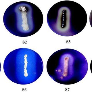 Morphological Characterization Of Streptomyces Isolates Download