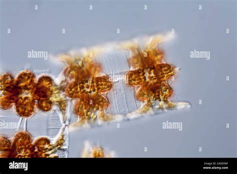 Light Micrograph Of Odontella Sp Marine Diatoms Odontella Forms