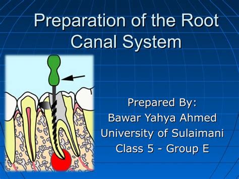 Preparation Of The Root Canal System Ppt
