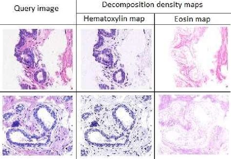 Figure 1 From Blind Stain Decomposition For Histo Pathology Images