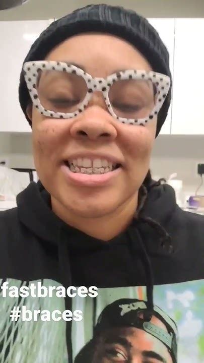 Fastbraces Braces Dental Teeth Youtube