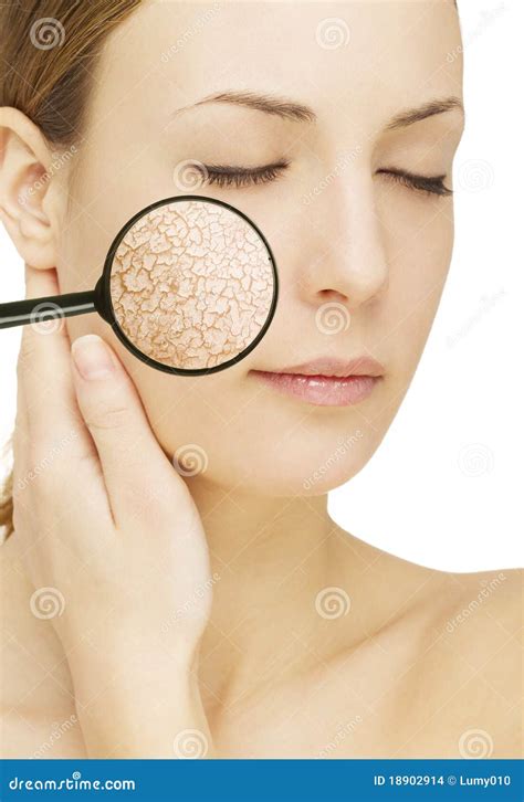 Cracked Skin Royalty Free Stock Image CartoonDealer Com 18902914