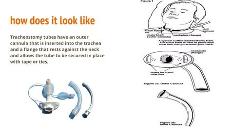 Tracheostomy Care And Management Pptx