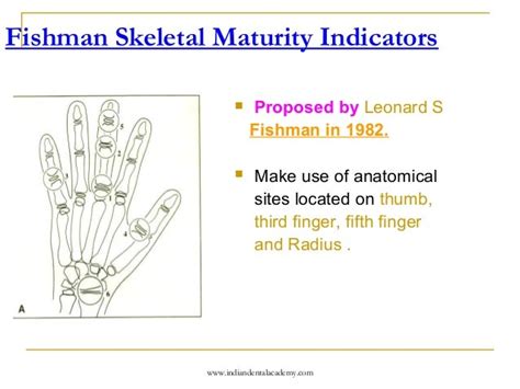 skeletal maturity indicator 2