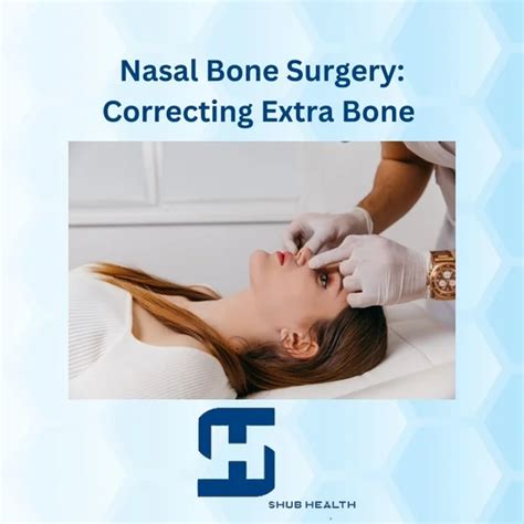 Ppt Nasal Bone Surgery Correcting Extra Bone 1 Powerpoint