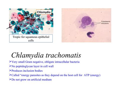 Sexually Transmitted Infections Ppt