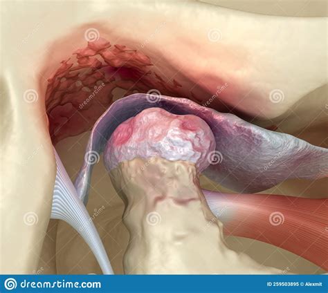 Tmj The Temporomandibular Joints Healthy Occlusion Anatomy Medically