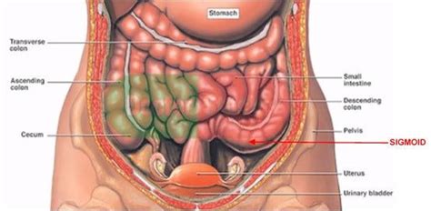 Cupping For Gut Health Constipation Detoxification Artofit