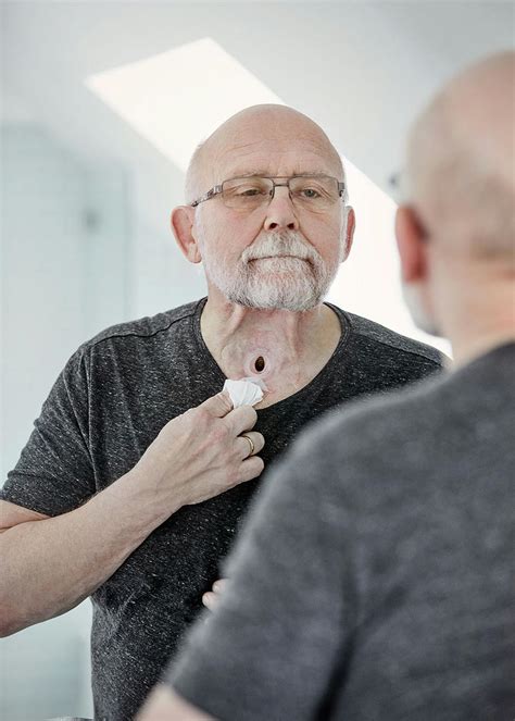 Come Affrontare Una Laringectomia Atos Medical