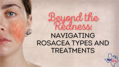 Navigating Rosacea Types And Treatments North Texas Medspa