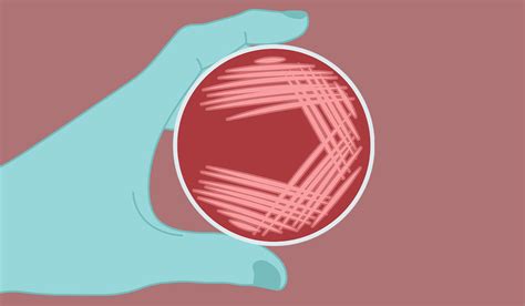 C Diff What Is Epidemiology Transmission And More Healthsimply