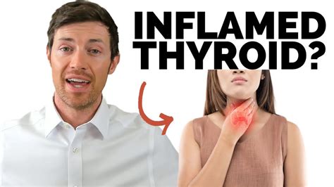 Thyroid Gland Swollen