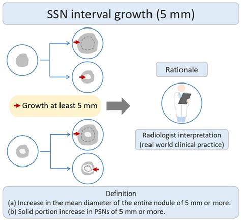 Managing Persistent Subsolid Nodules In Lung Cancer Education