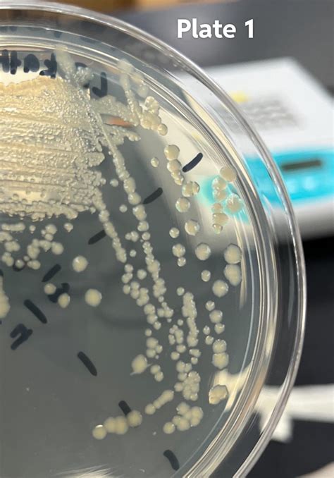 Need Help Identifying Two Unknown Bacteria Rmicrobiology