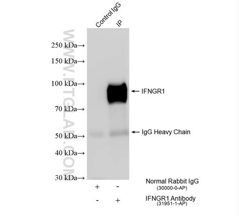 Ifngr1 Cd119 Antibody 31951 1 Ap Proteintech