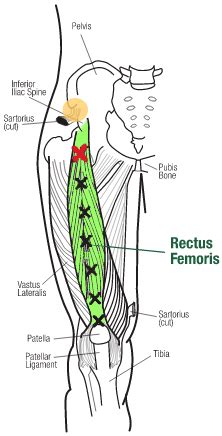 Sartorius Trigger Points