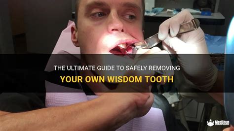 The Ultimate Guide To Safely Removing Your Own Wisdom Tooth Medshun