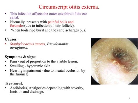 Otitis Externa On Human Ear Pathophysiology Pptx Ear Nose And