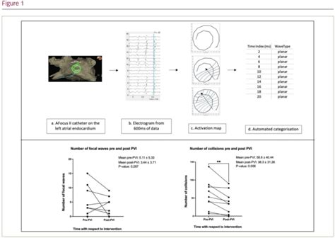 42retro Map A Novel Algorithm To Map Persistent Atrial Fibrillation Shows A Reduction In