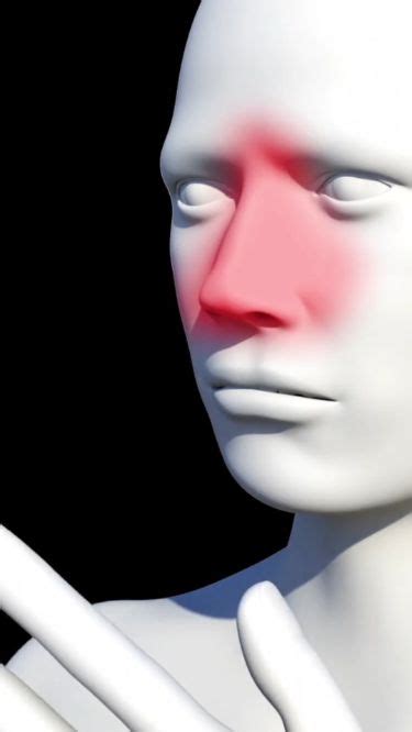 A Sinus Infection May Be The Cause Of A Toothache In 2025 Dental Fun