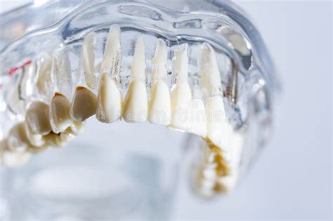 Dental Implant Artificial Tooth Roots Into Jaw Root Canal Of Dental
