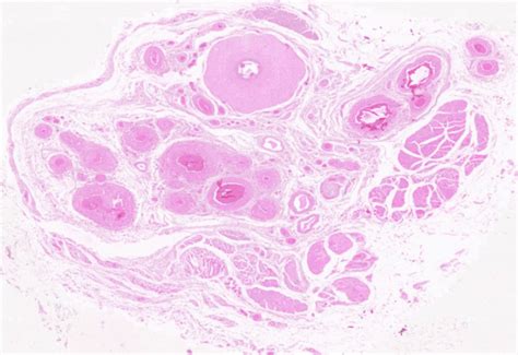Male Reproductive System Histology Education