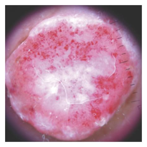 an example of data augmentation for input image a original image