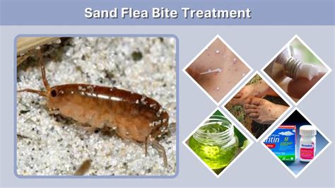 Sand Fleas Identification Bites Treatment And Removal