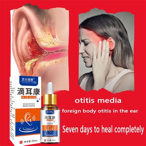 Ear Drops Ear Acute Otitis Wax Removal Ear Tinnitus Ear Drops Ear Care