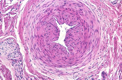Corpus Cavernosum Light Micrograph Stock Image C0611689 Science