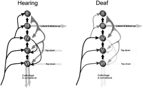 Schematic Illustration Of The Deficits In The Primary Auditory Cortex
