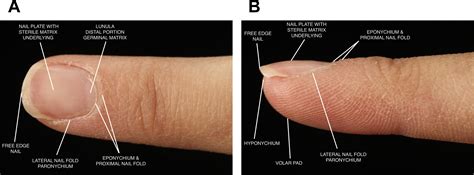 Grafting And Other Reconstructive Options For Nail Deformities Hand
