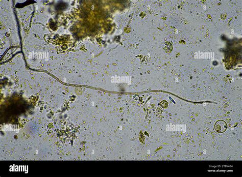 Microscopic Fungus And Microorganisms In A Sample In Australia Stock