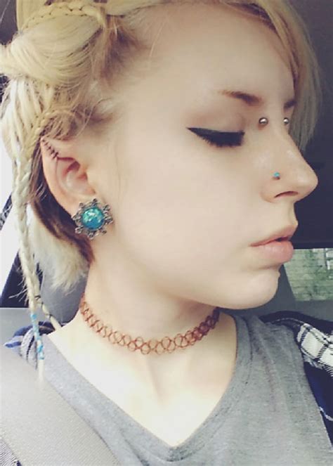 Woman Has Surgery To Shape Her Ears Like An Elf Extraie