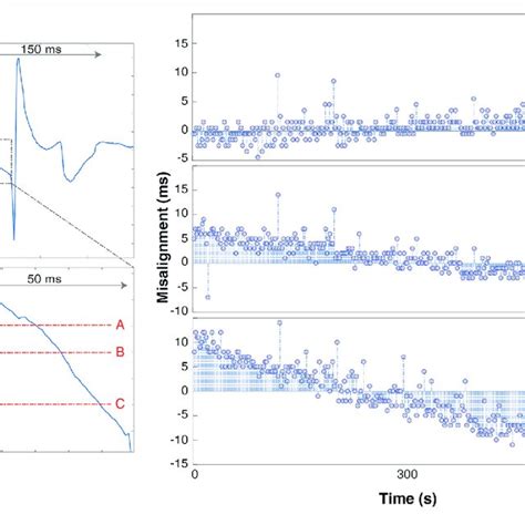 Trend Of Spike Misalignment Throughout The Recording Respectively