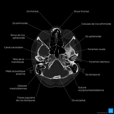 Anatomie Radiologique Radiographie Tdm Irm Kenhub