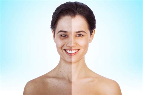 Jody Comstock Md Skin Spectrum Dermatology Tucson