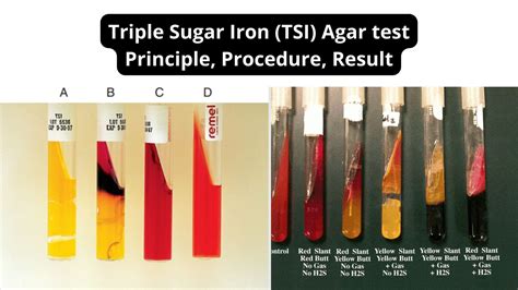 Phenylalanine Deaminase Test Principle Procedure Result Biology