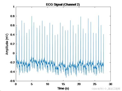「ecg信号处理——（3）wfdb工具包与mit Bih数据库读取」2024年11月13日 Csdn博客
