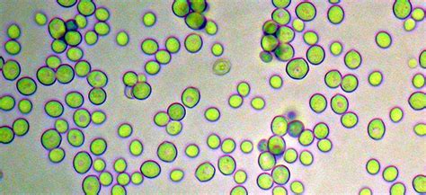 Baker S Yeast Plants Vogelbusch Biocommodities