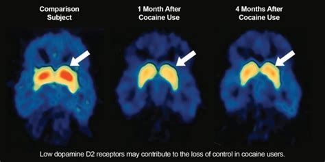 How Long Does It Take To Quit Porn Porn Addiction Recovery Timeline