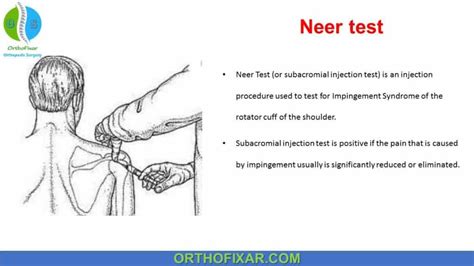 Jerk Test Overview Easily Explained Orthofixar 2026