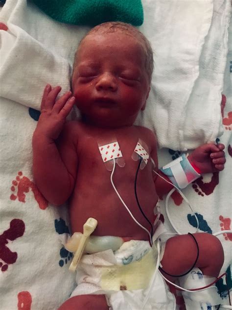 Born At 31 Weeks Pregnant
