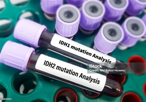 Blood Sample For Idh1 And Idh2 Mutation Analysis Test To Identify In A