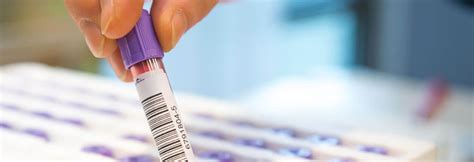 Gonorrhoea Test Gonorrhoea Testing London Doctors Clinic