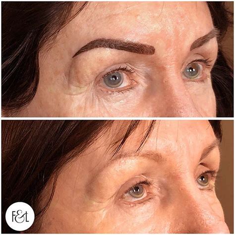 Brow Tattooing Is For All Ages Look At The Transformation We Created