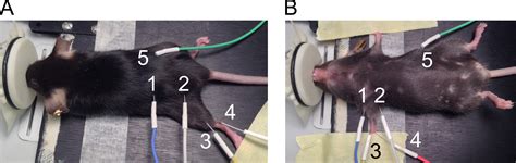 In Vivo Electrophysiological Measurement Of Compound Muscle Action