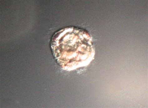 Developmental Biology In The Ocean 2013 Urechis Unicinctus Trochophore