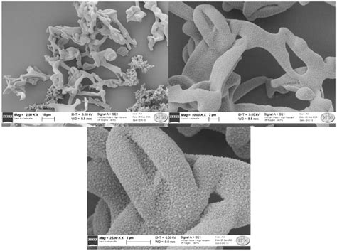 Chemical And Physical Characterisation Of Macroaggregated Human Serum