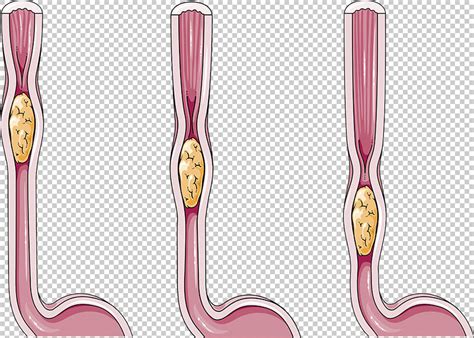 Peristalsis Of The Intestines Vector